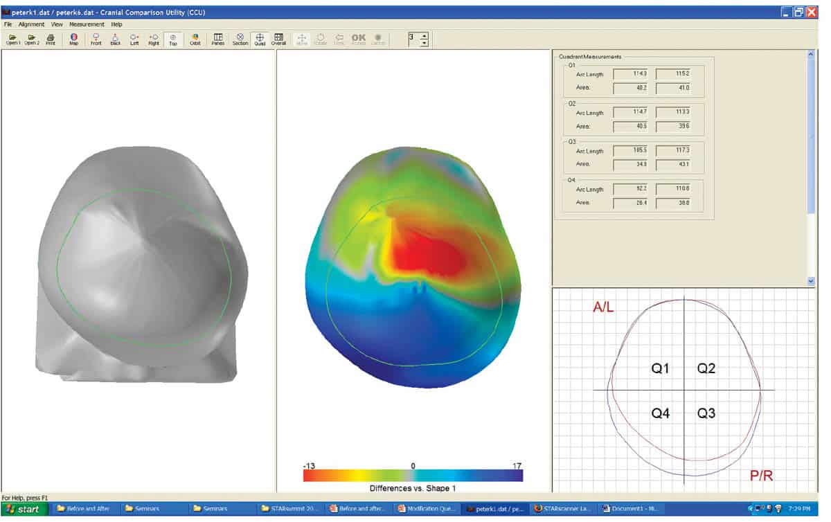 Starscanner - Starband
